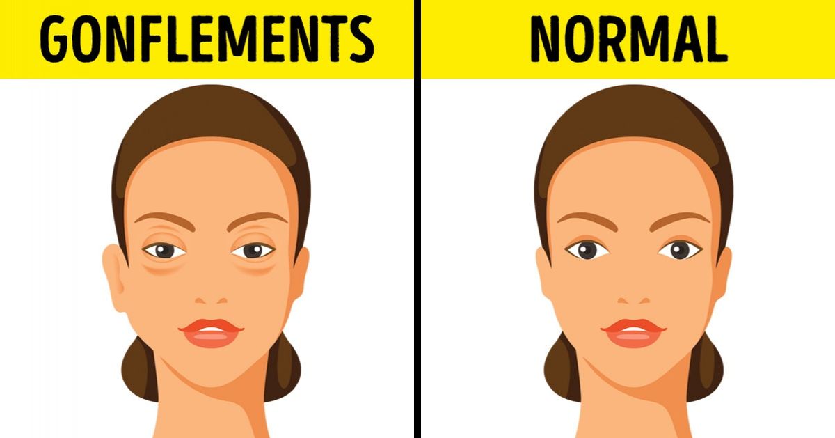 Une méthode simple pour éliminer les gonflements du visage en 2 minutes ...