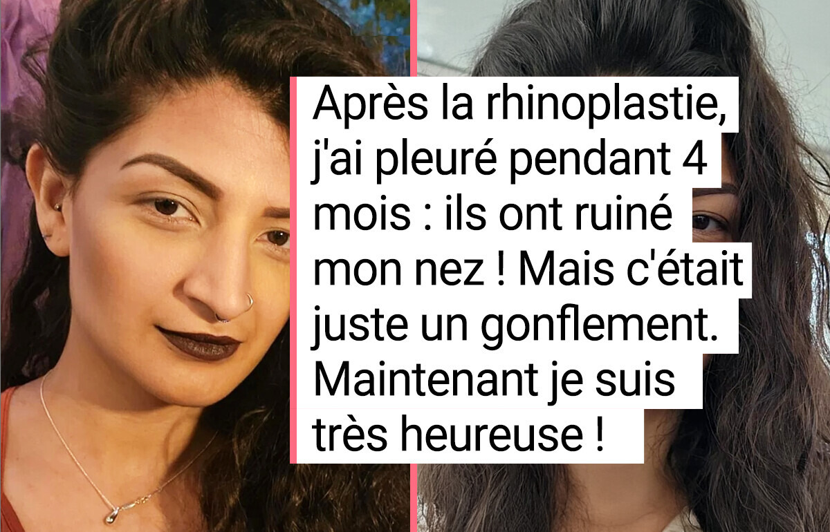 20+ Photos où la comparaison fait toute la différence